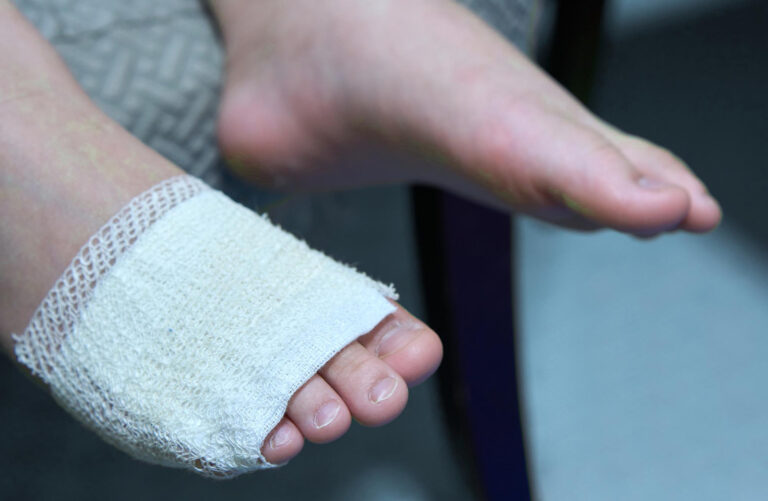 Diabetic Foot Ulcer Wound Care in Los Angeles - Dr. Ben Behnam